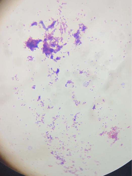 Solved List The Possibilitesf Of Unknown Microorganism Using