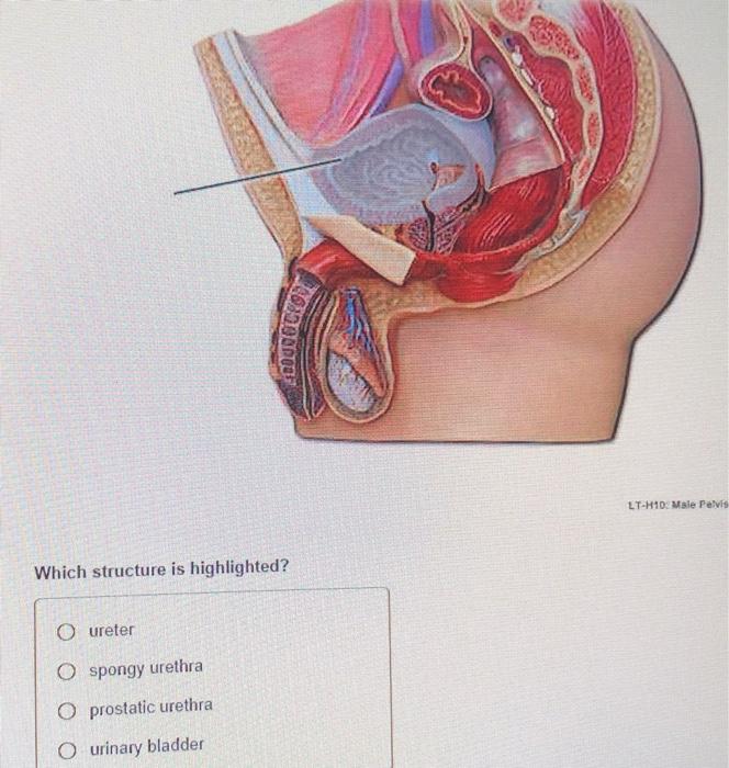 Solved LT-H10 Maie Pelvis Which structure is highlighted? | Chegg.com