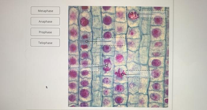 Solved Metaphase Anaphase Prophase Telophase | Chegg.com