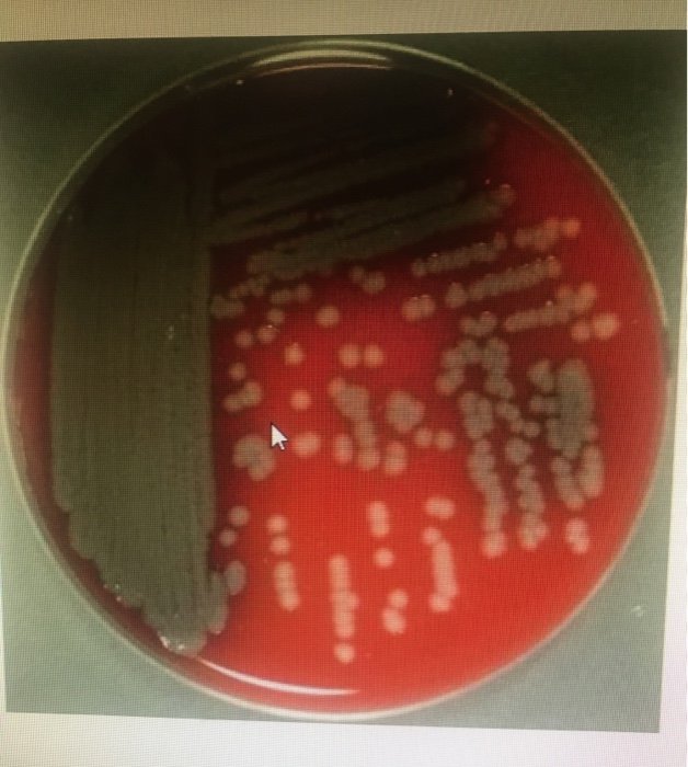Blood agar Microorganisms Growth Hemolysis pattern | Chegg.com
