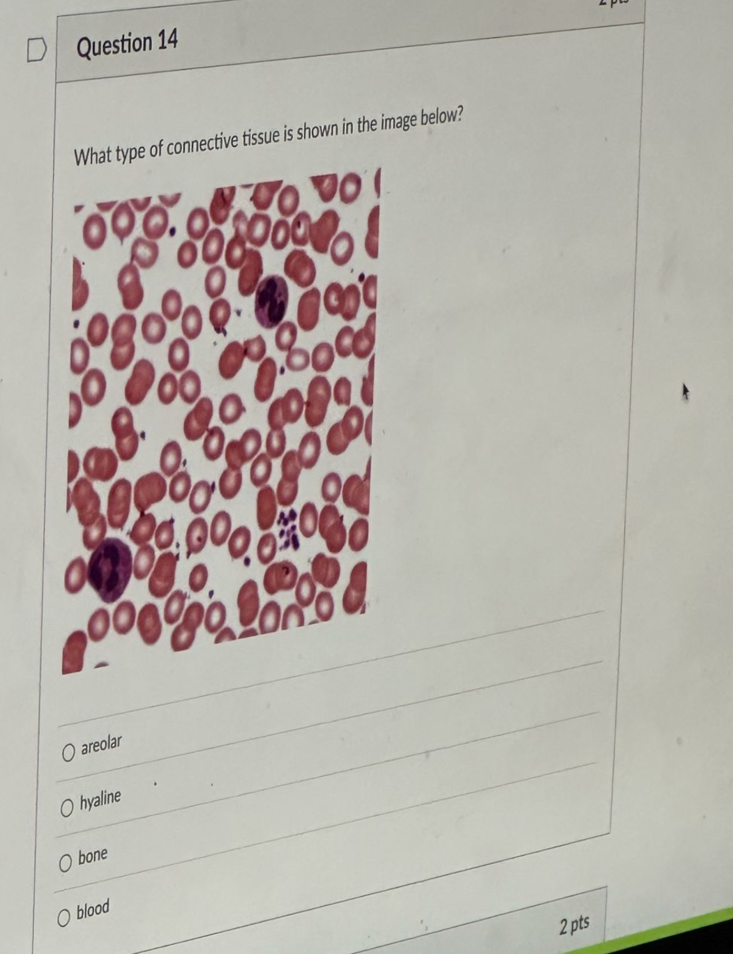 Solved Question 14What type of connective tissue is shown in | Chegg.com