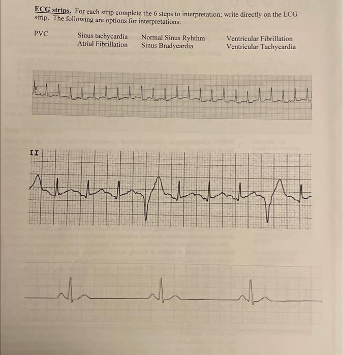 ECG strips. For each strip complete the 6 steps to | Chegg.com
