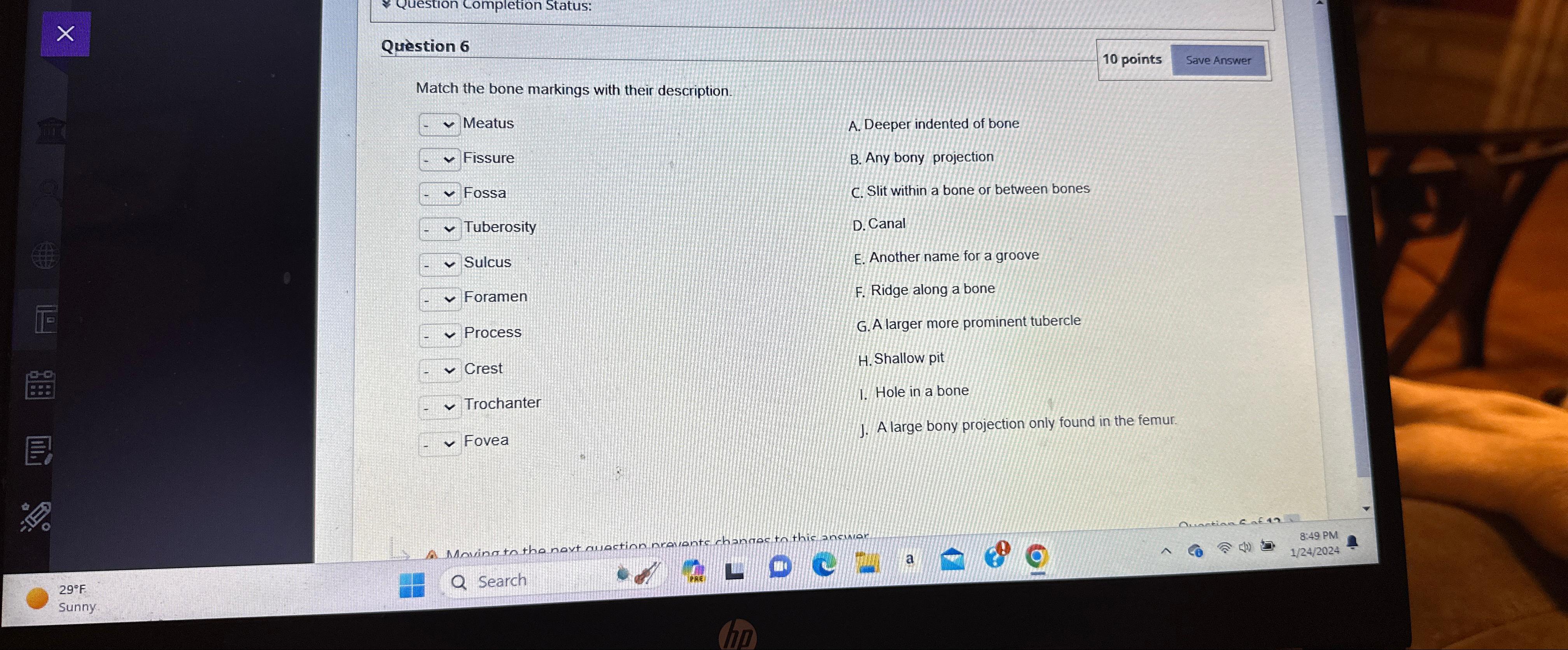 Solved Quèstion 610 ﻿pointsMatch the bone markings with | Chegg.com