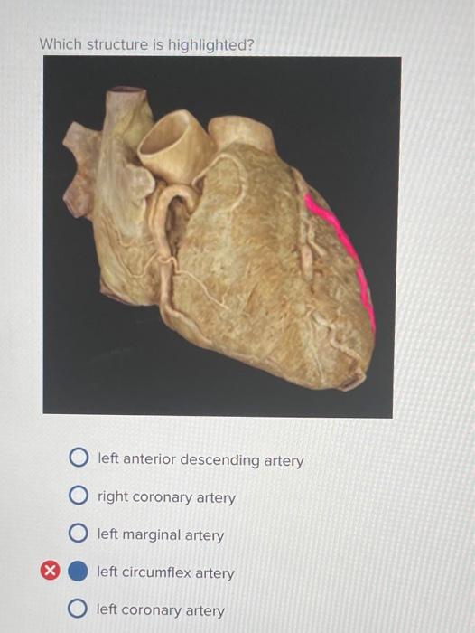 Solved Which structure is highlighted? O left anterior | Chegg.com