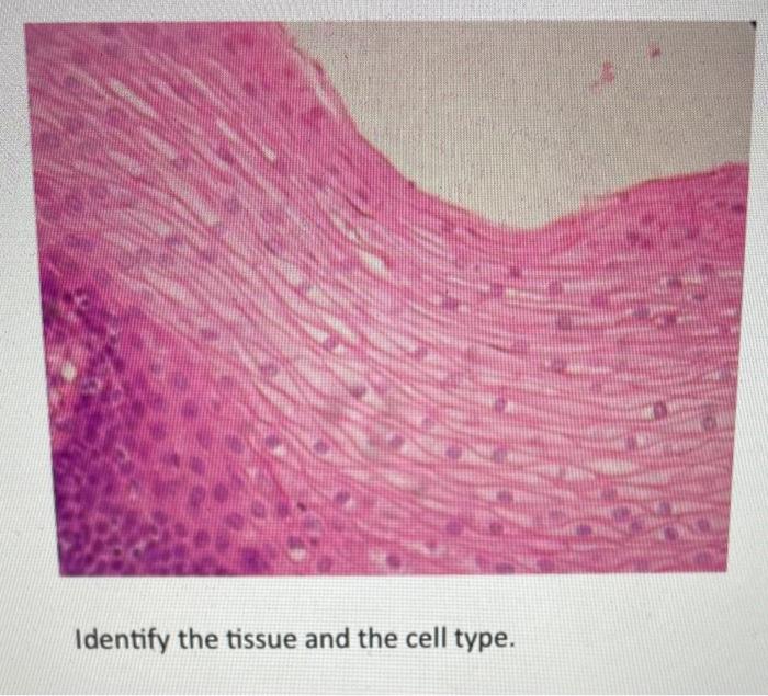 Solved What Is The Term For The Backside In The Anatomical Chegg