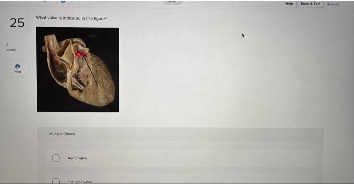 Solved What valve is indicated in the figure? Multiple | Chegg.com