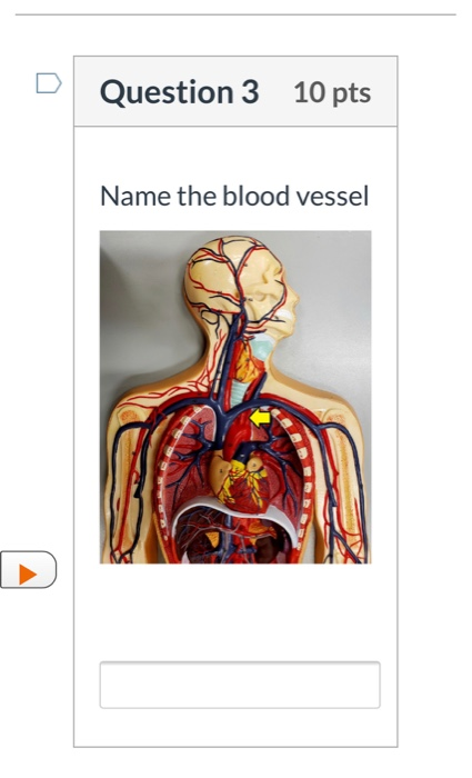 Solved Question 1 10 pts Name this blood vessel (in red) D | Chegg.com
