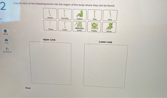 Solved Classify each of the following bones into the region | Chegg.com