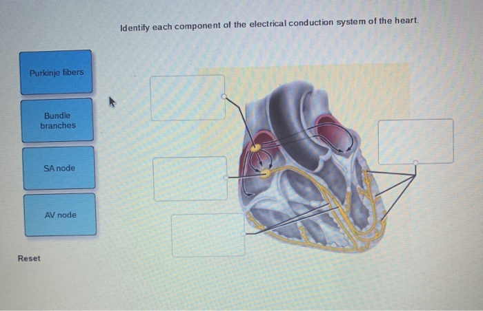 Solved Identify each component of the electrical conduction | Chegg.com