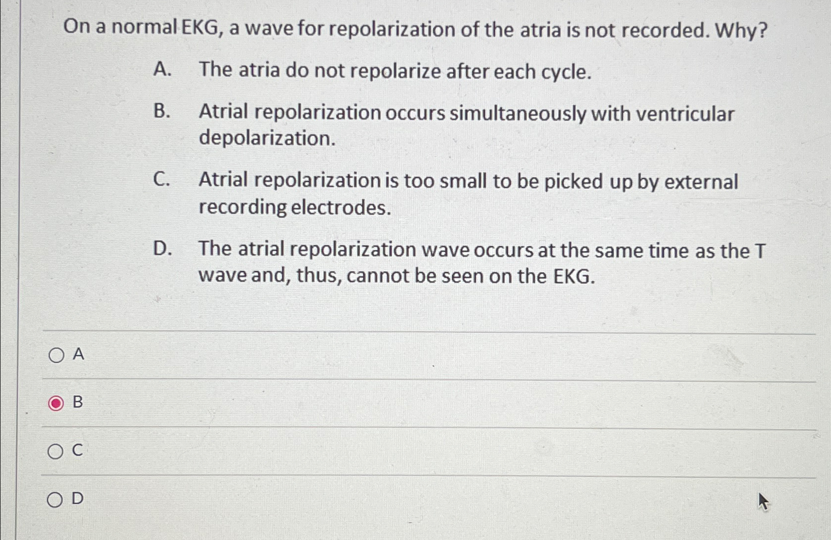 Solved On a normalEKG, a wave for repolarization of the | Chegg.com