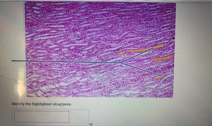 Solved Identify the highlighted structures. | Chegg.com