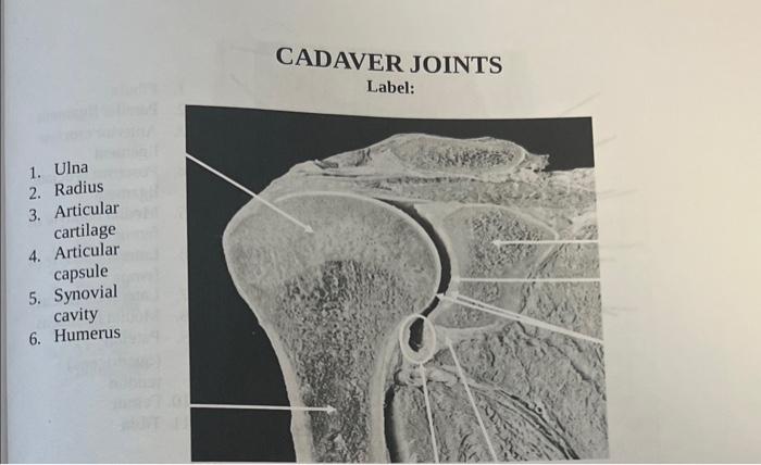 Solved CADAVER JOINTS Label: 1. Ulna 2. Radius 3. Articular | Chegg.com