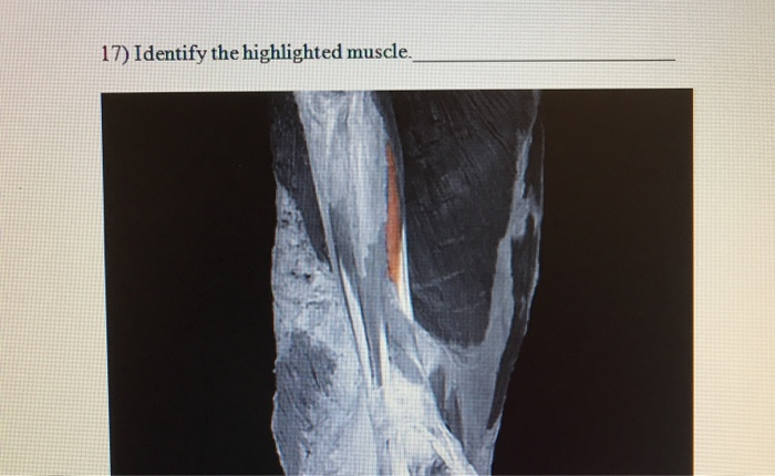 Solved 15) Identify the highlighted muscle. 16) Identify | Chegg.com