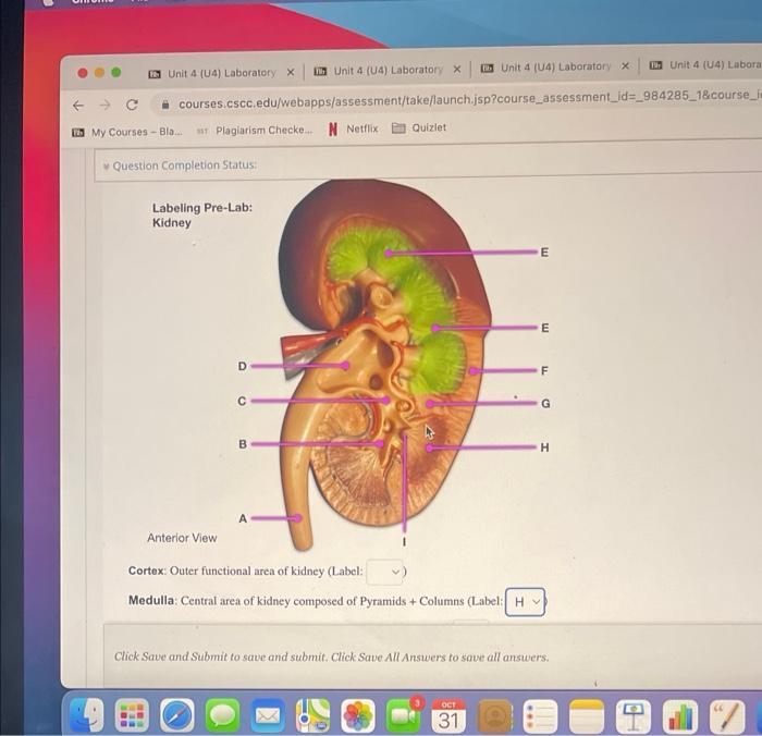 Solved Lab Kidt Anter Cortex: Outer functional area of | Chegg.com