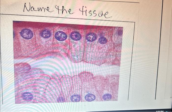 Name the tissue | Chegg.com