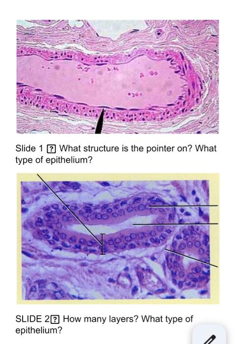 Solved Slide 3→ Type of epithelium? Layers? Where would I | Chegg.com