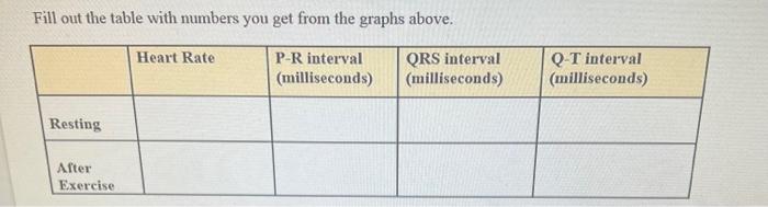Solved In this activity, you will use the EKG three-second | Chegg.com