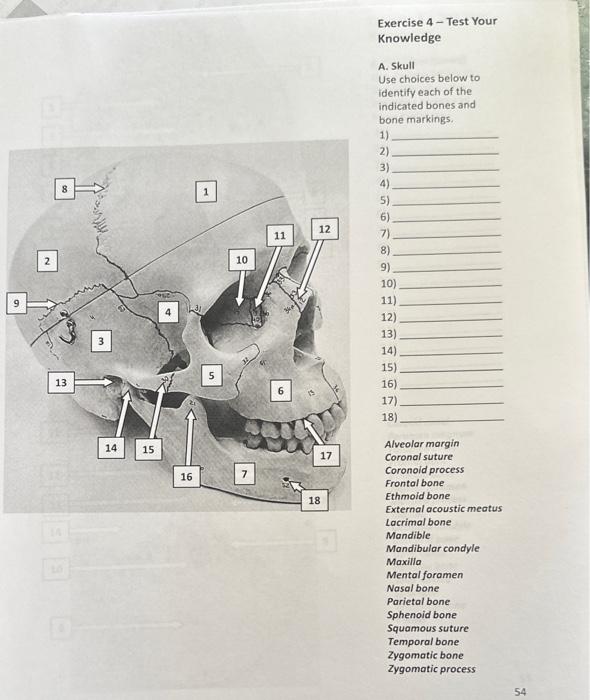 Solved Alveolar margin Coronal suture Coronoid process | Chegg.com