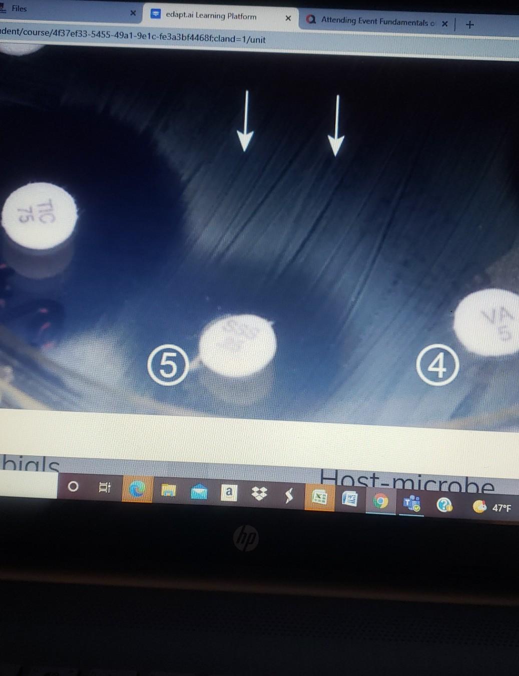 Solved Select all the numbers associated with the antibiotic | Chegg.com