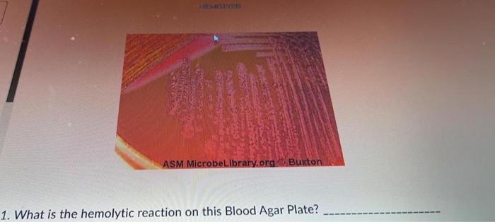 Solved SC ASM MicrobeLibrary.org Buxton 1. What is the | Chegg.com