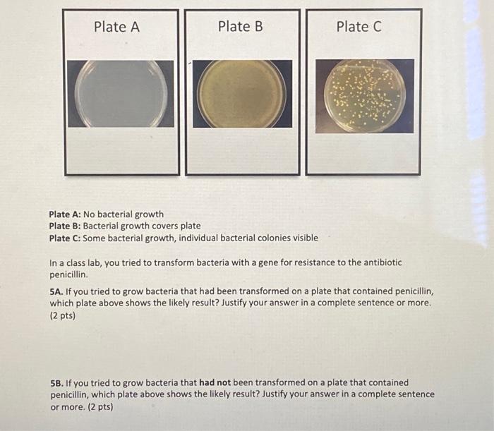Solved Plate A: No bacterial growth Plate B: Bacterial | Chegg.com