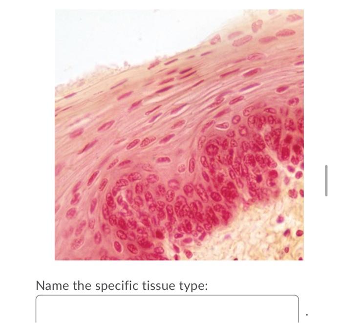 Solved + 1. General tissue type: EPITHELIAL Specific tissue | Chegg.com