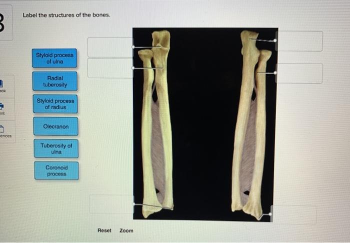 Solved Label the structures of the bones. B. Styloid process | Chegg.com