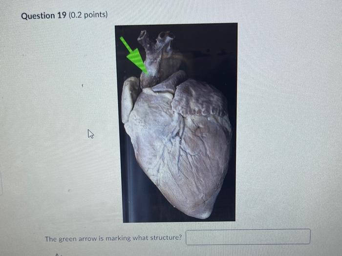 Solved Question 16 (0.2 points) Name the groove in which the | Chegg.com