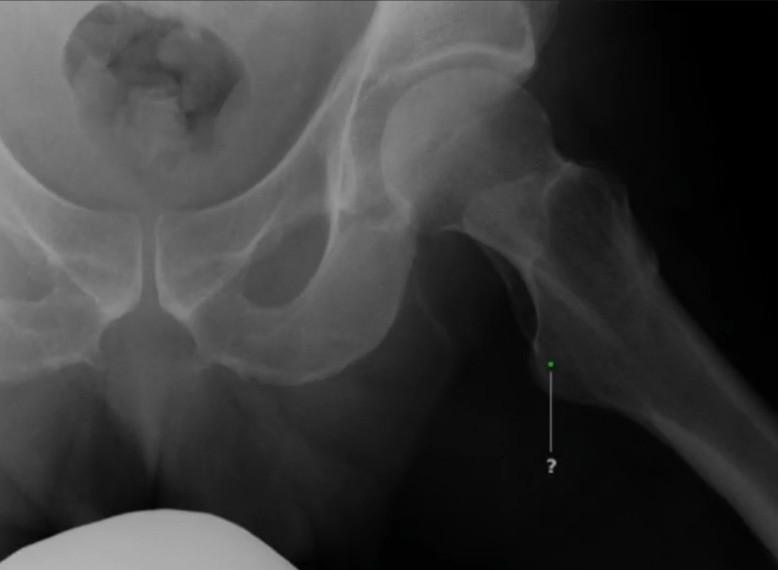 Solved identify the following structures that are pointed at | Chegg.com