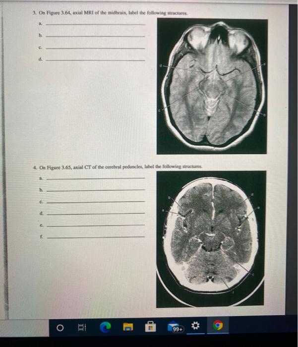 Solved 3. On Figure 3.61, axial MRI of the midbrain, label | Chegg.com