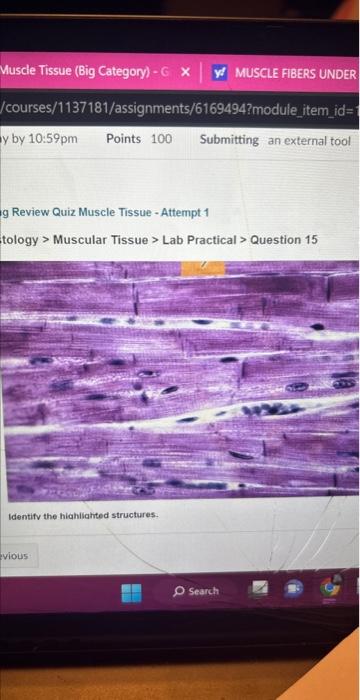 Solved ig Review Quiz Muscle Tissue - Attempt 1 tology > | Chegg.com