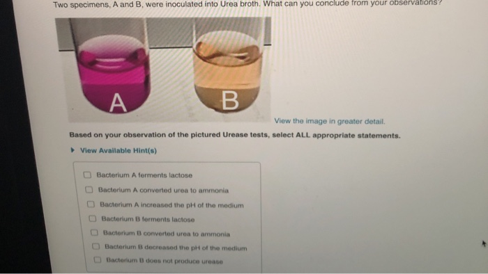 Solved Two specimens, A and B were inoculated into Urea | Chegg.com
