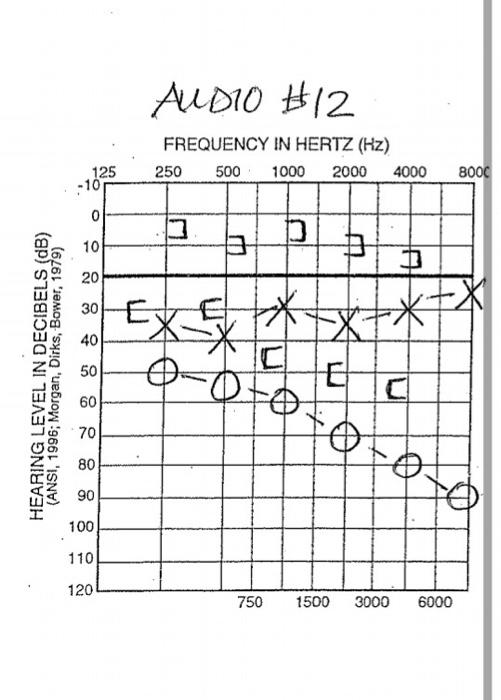 Solved classify the Audiogram #12 both the right and left | Chegg.com