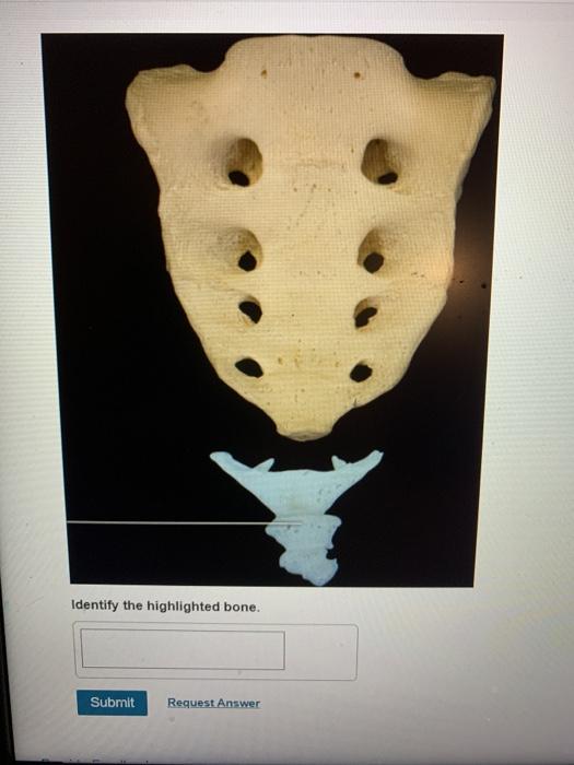 Solved Part A Identify the highlighted structures. | Chegg.com