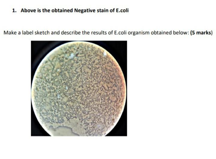 Solved 1. Above is the obtained Negative stain of E.coli | Chegg.com
