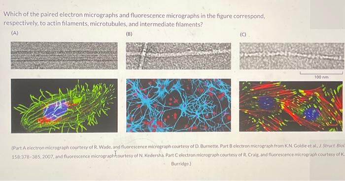 Solved Which of the paired electron micrographs and | Chegg.com