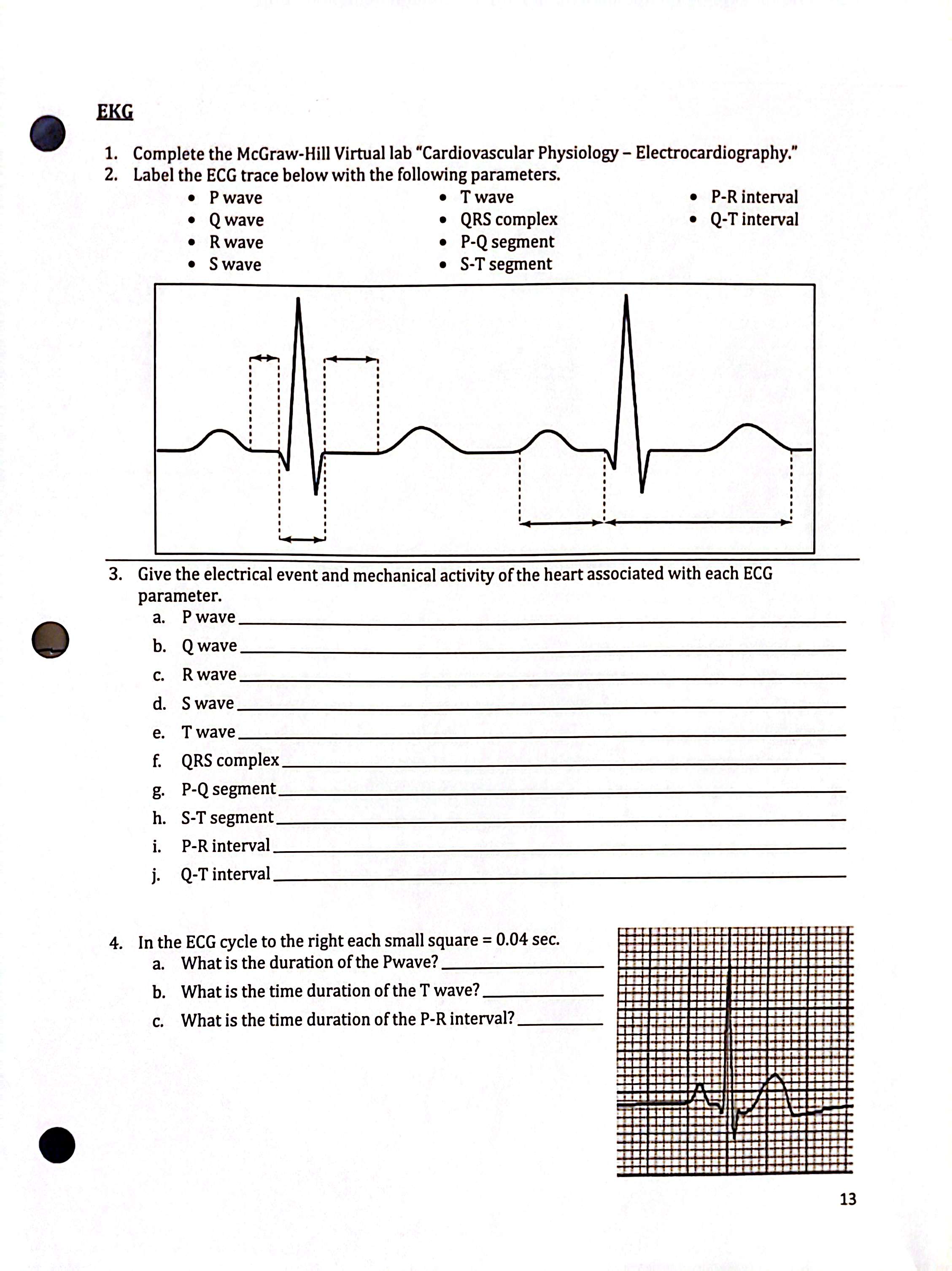 Solved EKGComplete the McGraw-Hill Virtual lab | Chegg.com