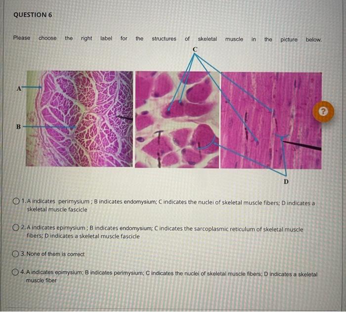 Solved Please choose the right label for the structures of | Chegg.com