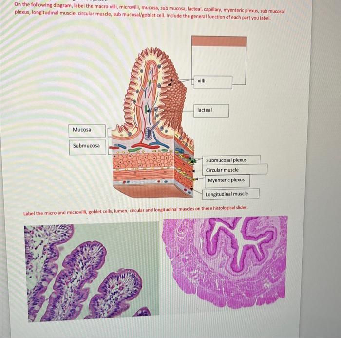 Solved On the following diagram, label the macro villi, | Chegg.com