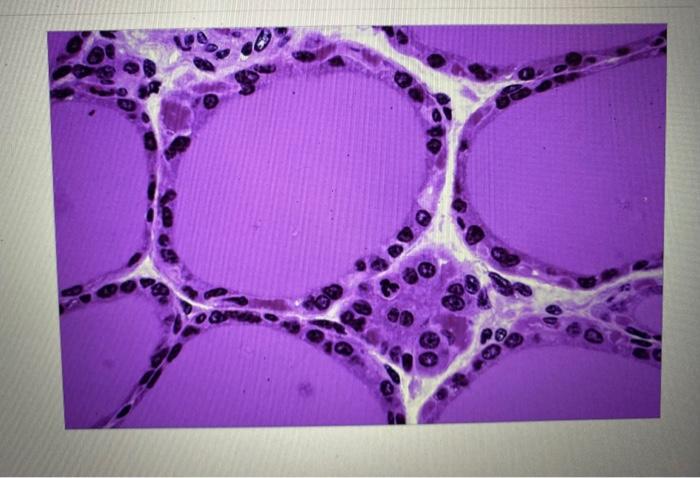 Solved In the tissue shown, what is the name of the purple | Chegg.com