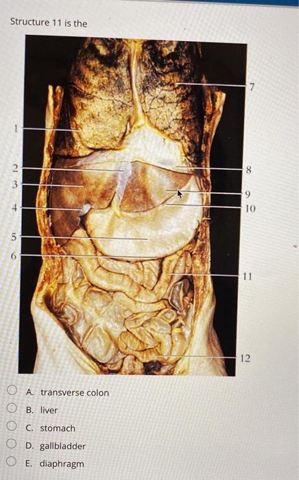 Solved Structure 11 is the 7 8 2 3 9 10 11 12 O A. | Chegg.com
