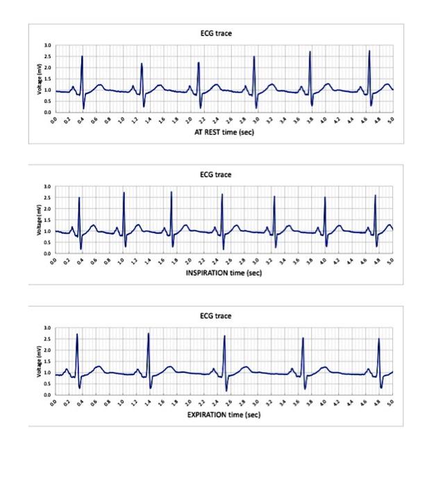 Solved TABLE 1: Average ECG measurements during the | Chegg.com