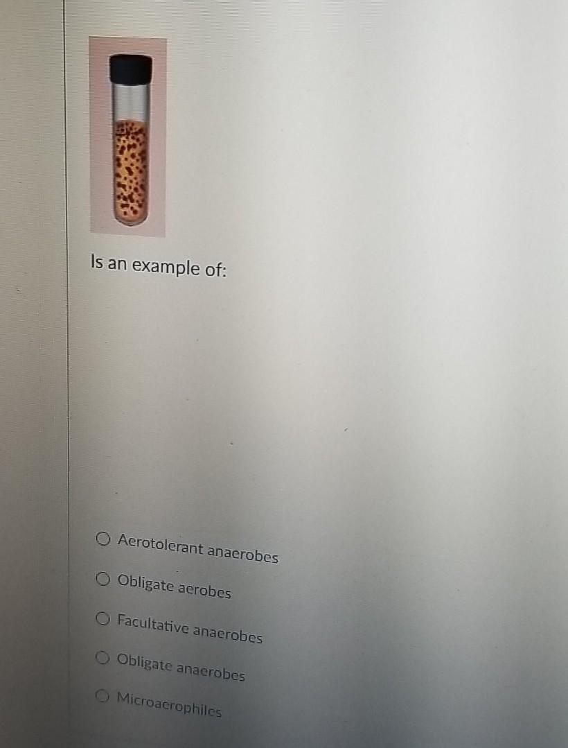 Solved Is an example of: Aerotolerant anaerobes Obligate | Chegg.com