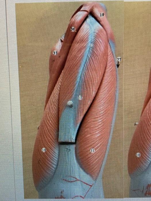 Solved Question 6 Muscles of lower extremity - Identify the | Chegg.com
