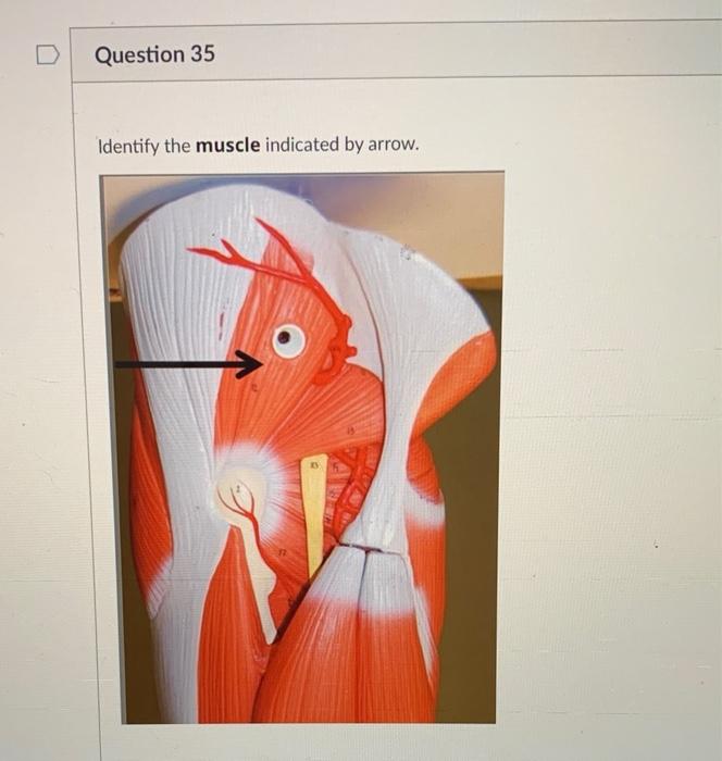 Solved Identify the muscle indicated by arrow. Identify the | Chegg.com