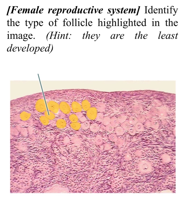 Solved [Female reproductive system] Identify the structure | Chegg.com