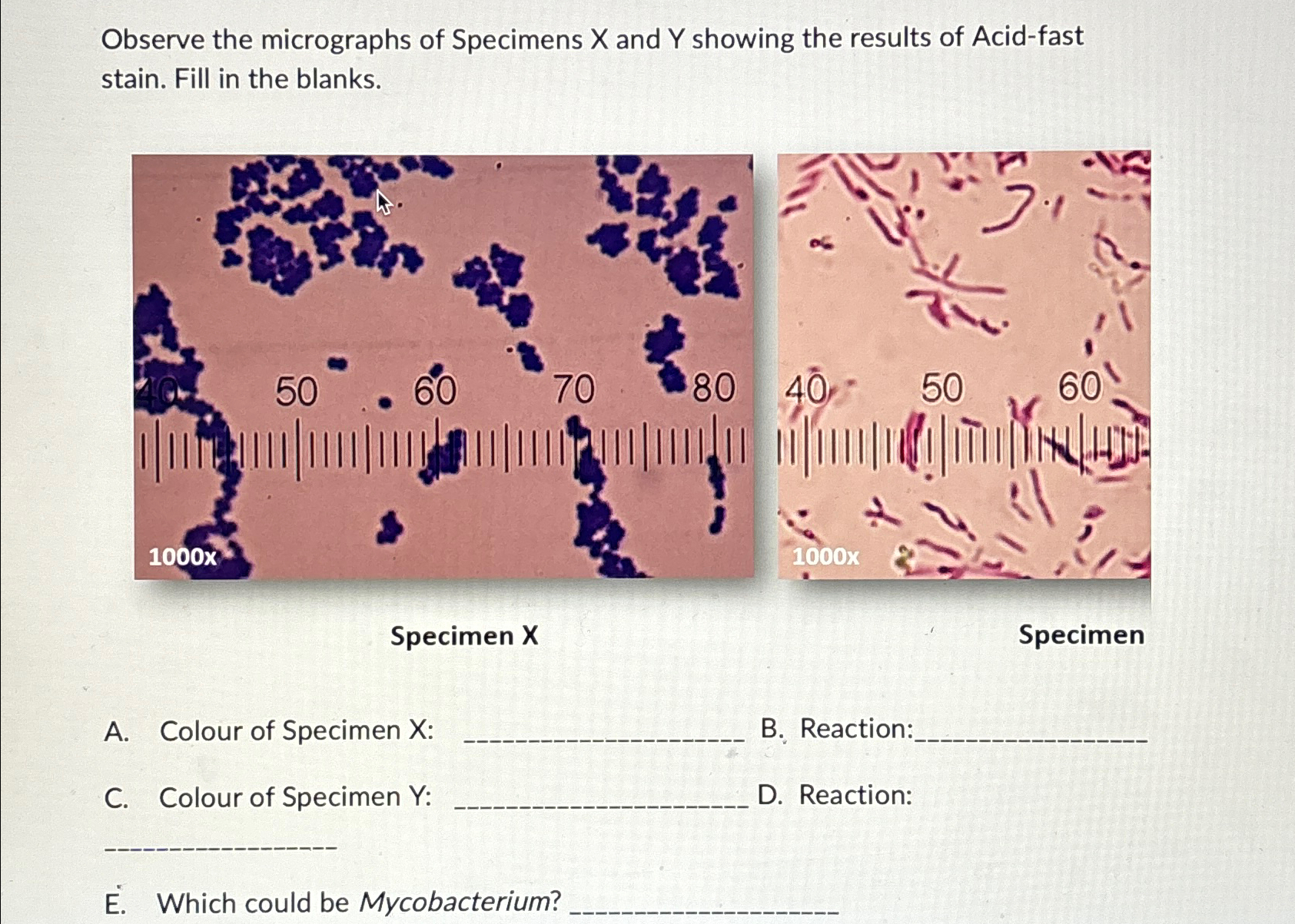 Solved Observe the micrographs of Specimens x ﻿and Y | Chegg.com