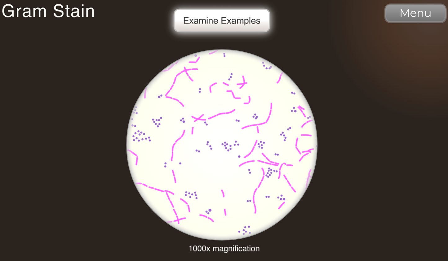 Solved describe the morphology of the bacteria in the | Chegg.com