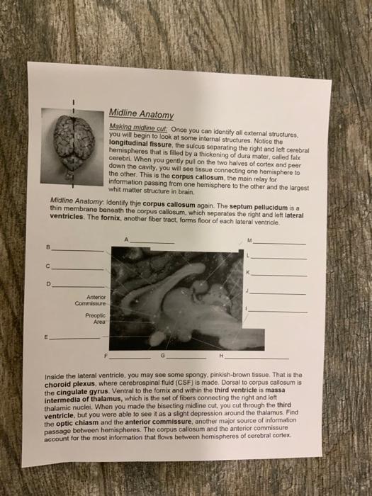 Solved Midline Anatomy Making midline cut: Once you can | Chegg.com