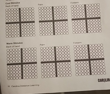 Solved Warm StimulusBack of hand16 ﻿Carolina Distance | Chegg.com